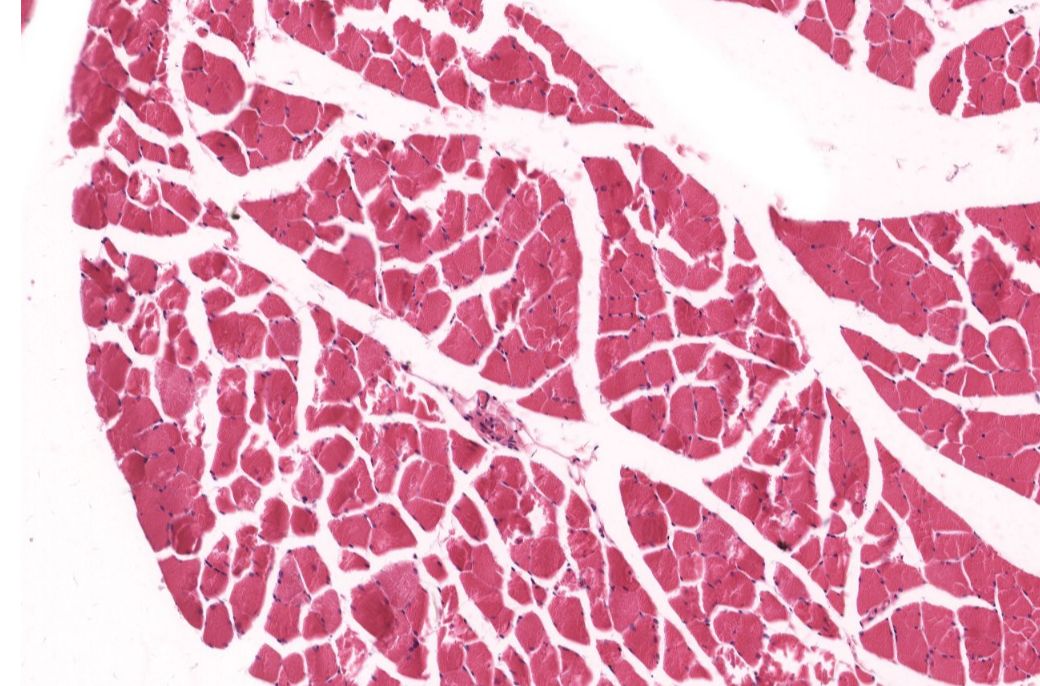 Músculo esquelético-Departamento de Histología